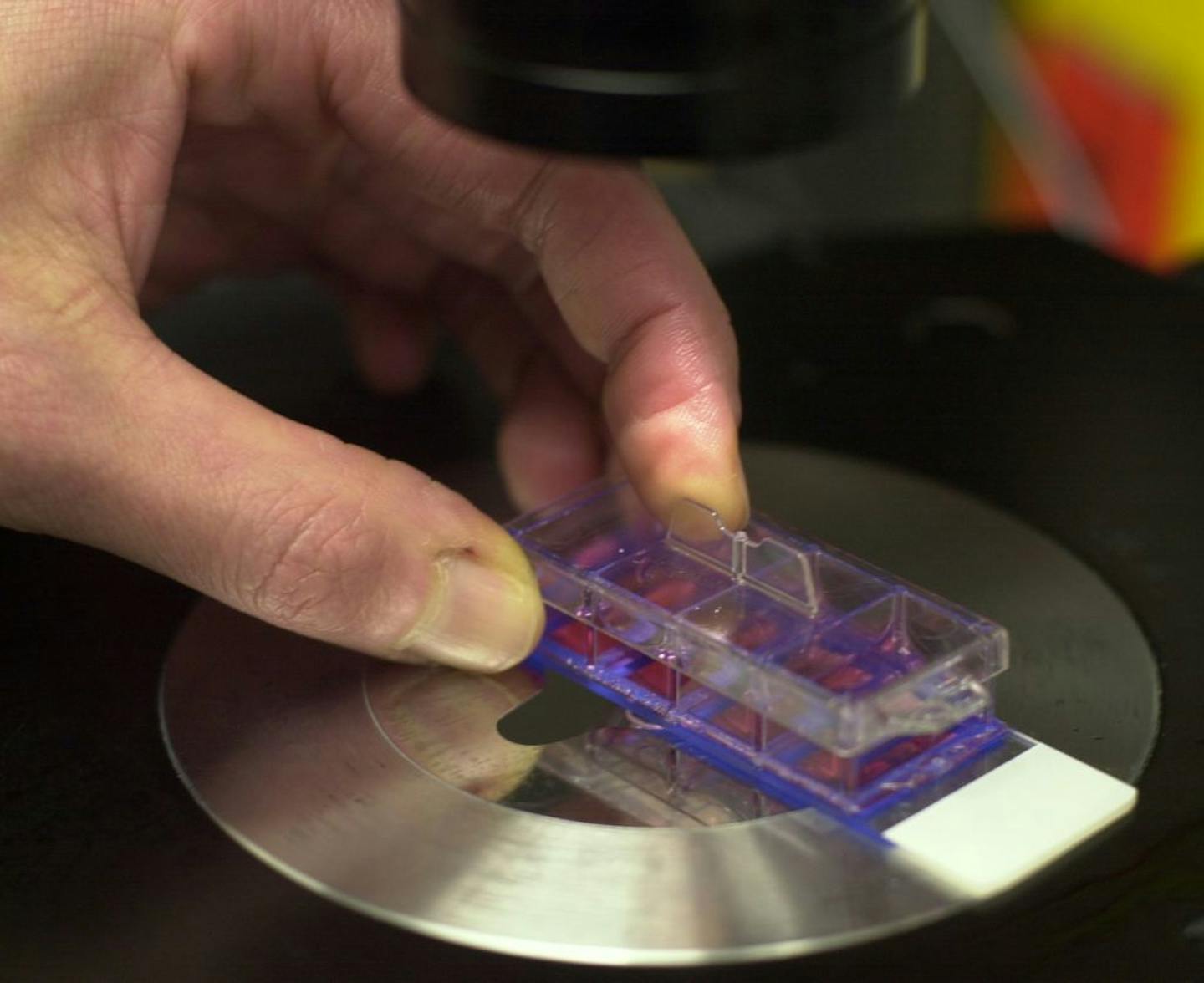 Landmark University of Minnesota papers on Alzheimer's disease and stem ...