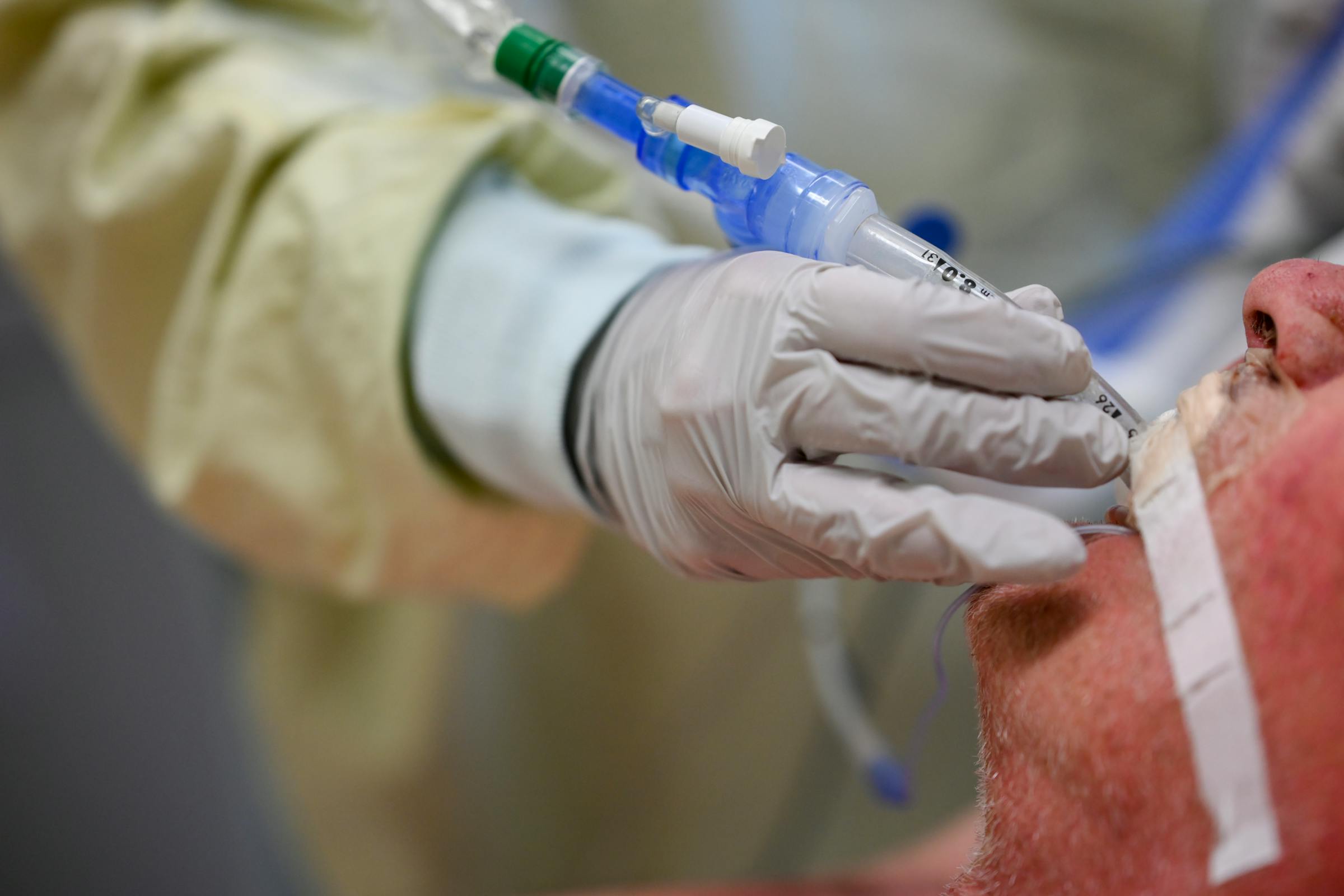COVID-19 severity changing in Minnesota hospitals