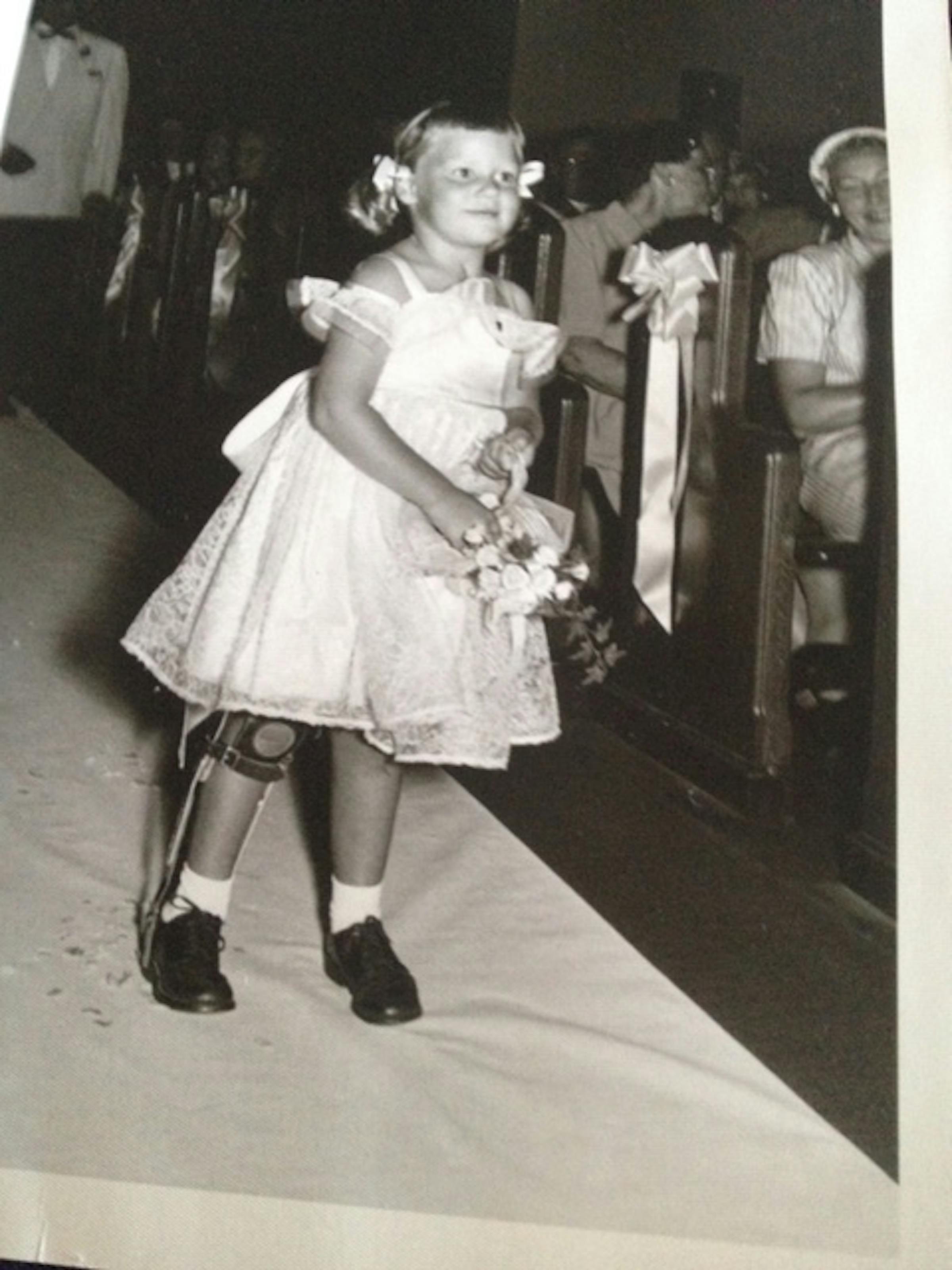 As a polio survivor, I’m part of a dying breed — maybe