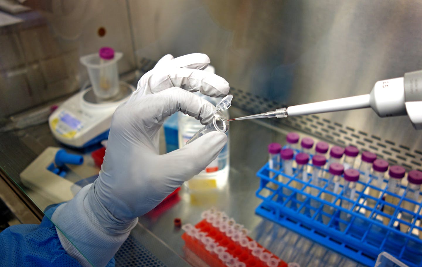 Roseville-based Rebiotix sold to Swiss drugmaker Ferring Pharmaceuticals