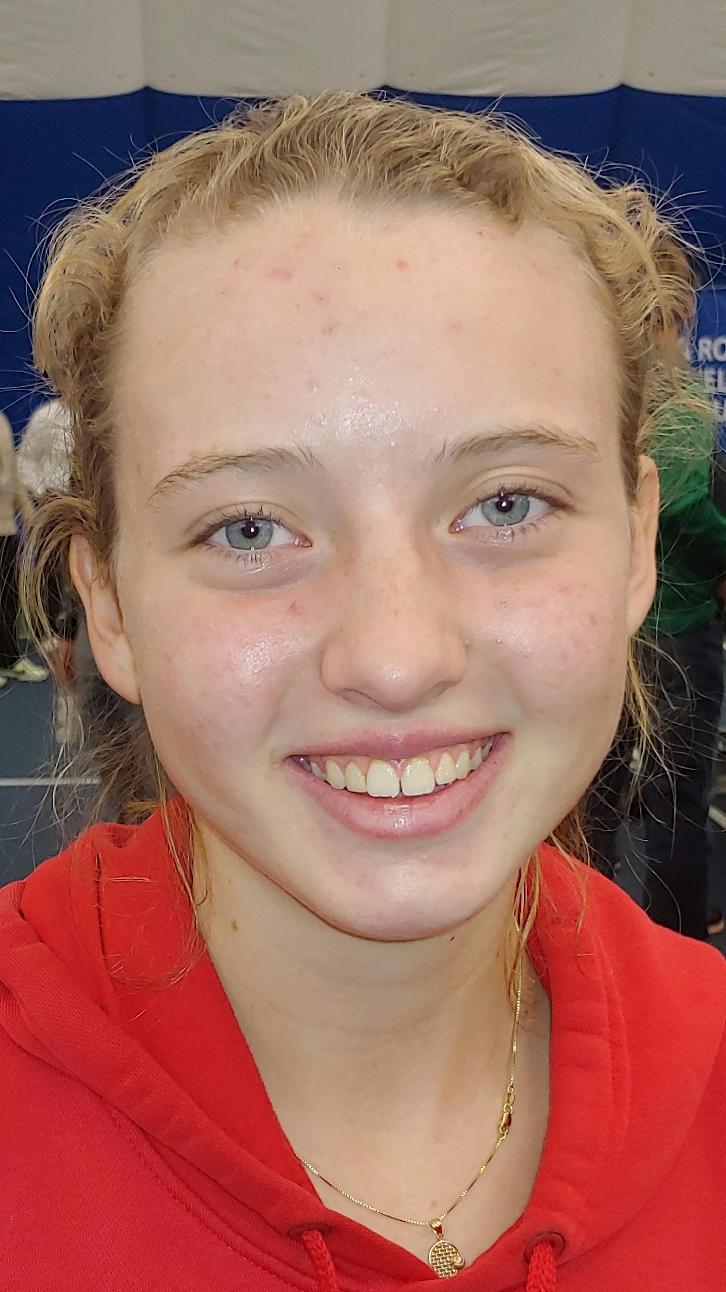 Defending girls' tennis champions Breck and Minnetonka are back and loaded