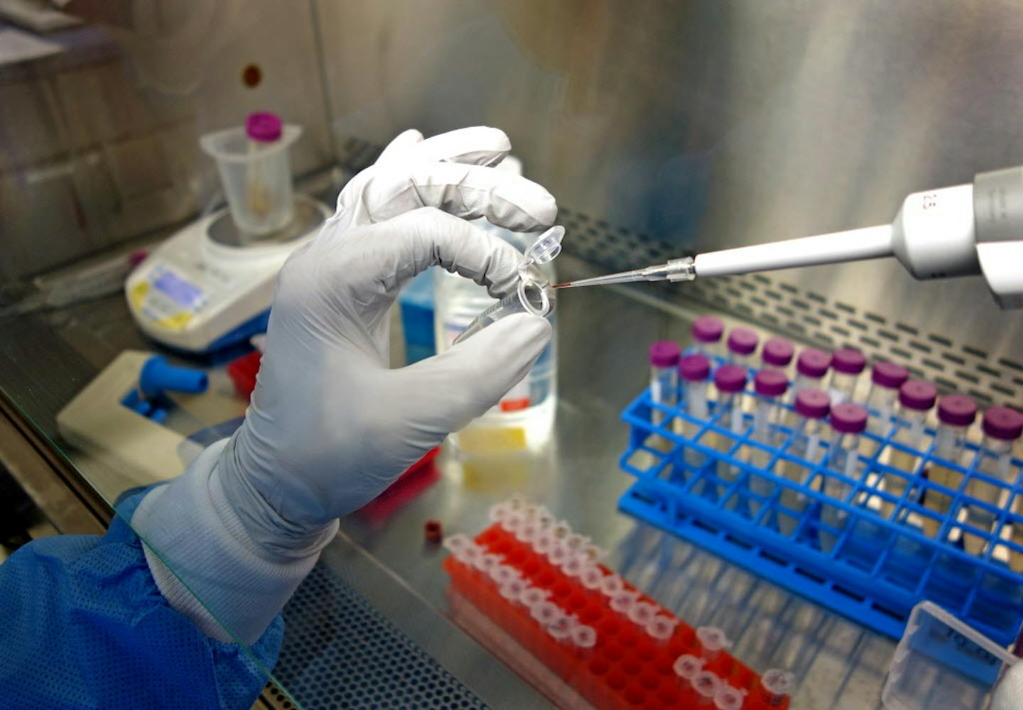 How's your gut bacteria? Minnesota-based Rebiotix unveils new system to ...